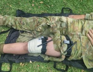 Tourniquets and Catastrophic Bleeding - Chieftain Training